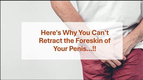 Understanding Phimosis Reasons For Unable To Retract Foreskin Of Your