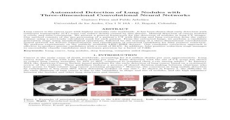 Pdf Automated Detection Of Lung Nodules With Three Detection Of