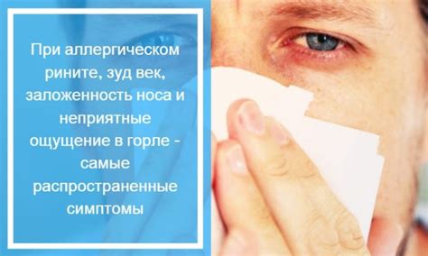 Аллергический ринит — симптомы и лечение у взрослых