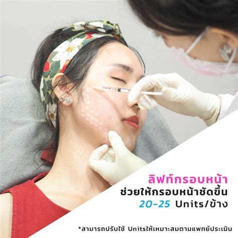 Botox 200 Unit ทำส่วนไหนบนใบหน้าได้บ้าง 👱🏻‍♀️ ลดขนาดกราม ปรับใบหน้าเล็กเรียว 25 50 Units