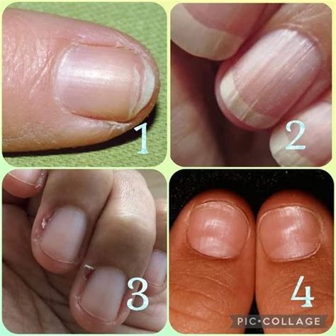 【happy Арьс үс хумсанд гарч байгаа өөрчлөлтүүд нь бидний биед зарим эрдэс витамин дутагдаж