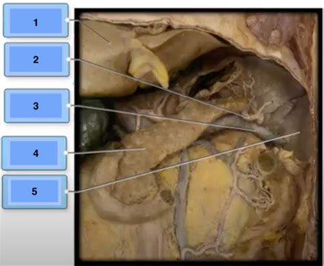 Bio202 Lab Practical 2 Lymphatic Anatomy Flashcards Quizlet