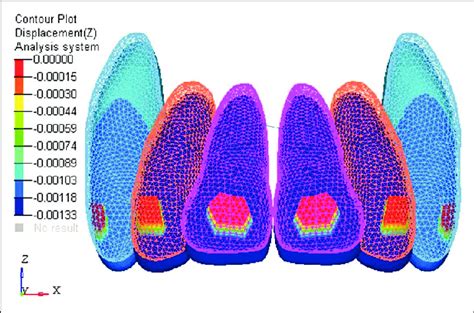 Displacement Contours Of Anterior Teeth Download Scientific Diagram