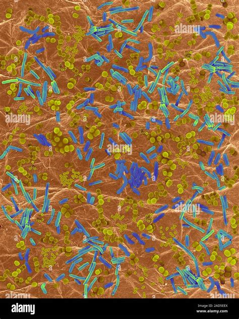 Coloured Scanning Electron Micrograph Sem Of Photocomposite Of Bacteria On Human Skin Types