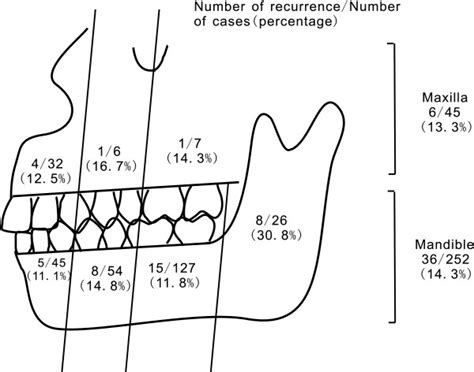 The Recurrence Rate Distribution Download Scientific Diagram