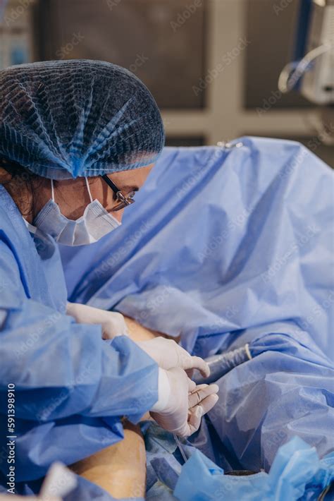 Preparing The Patient For Phlebectomy Surgery Surgical Field Marking
