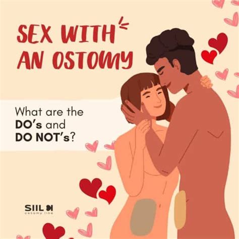 Can You Have Sex With A Ostomy Sex And Ostomy