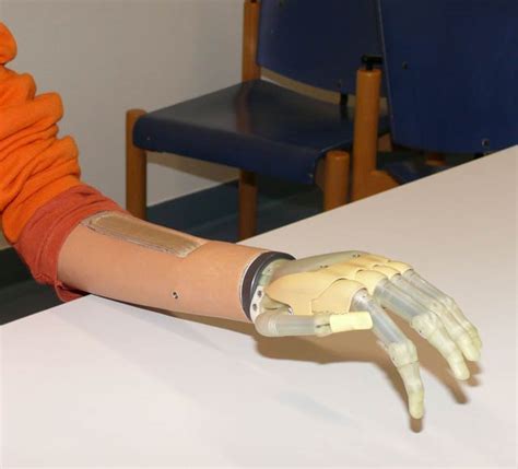 Bionic Humans Top 10 Technologies Live Science