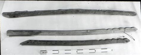 calculating bones