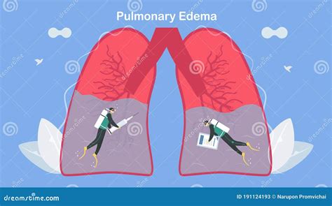 Pulmonary Edema