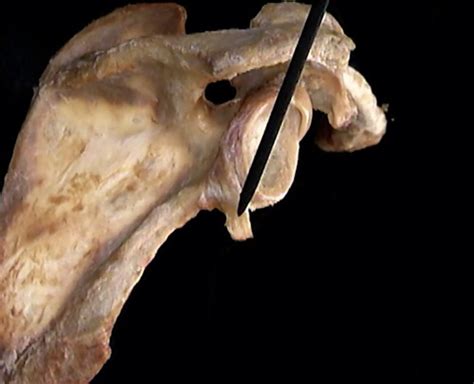 Muscles Of The Back And Shoulder Flashcards Quizlet