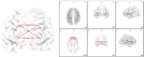 Phase Synchronization Analysis Demonstrating Increased Functional Download Scientific Diagram
