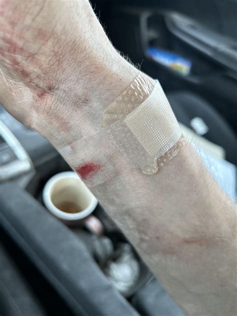 Gots An Ouchie Boo Boo Rouch