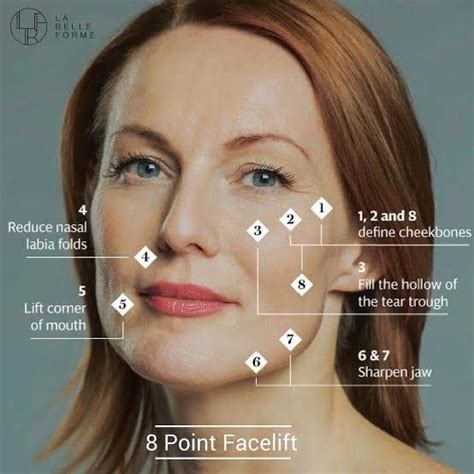 Pin By Denise Baylous On Aesthetics Facial Aesthetics Botox Fillers Injectables Fillers