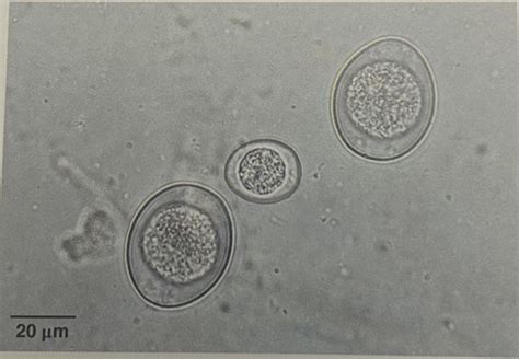 Nematode Identification By Pictures Flashcards Quizlet