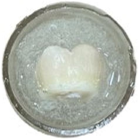 The Efficacy Of Remineralizing Materials On Artificial Enamel Lesions