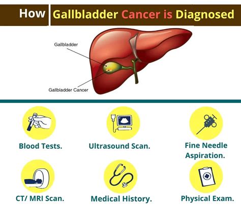Gallbladder Cancer Treatment And Surgery Dr Nikhil Agrawal Best In