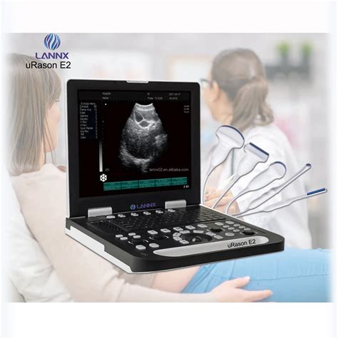 Lannx Urason E2 Ultrasound Diagnostic System Phased Array Cardiac Imaging Technology Bw