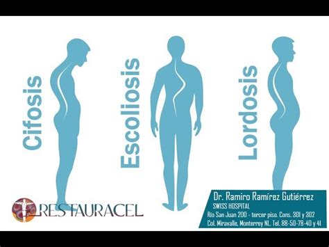 Todo Sobre Las Curvaturas De La Columna Vertebral Tipos Funciones Y