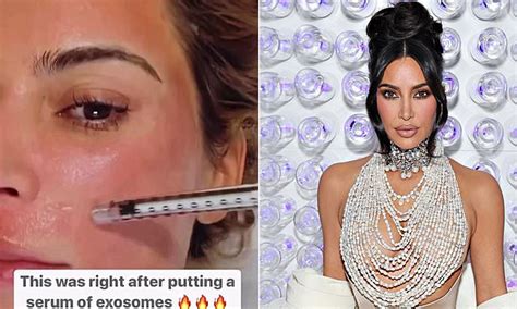 Celebrities New Botox Could Actually Cause More Harm Than Good