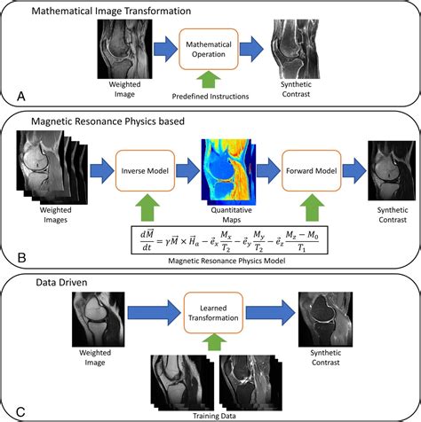 Synthetic Contrasts In Musculoskeletal MRI A Review Investigative Radiology