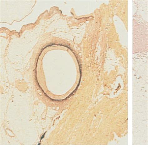 Micrographs Showing Micro Ct Cross Sectional Images Left Voxel Size