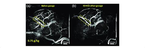 Maximum Intensity Projection Mip Of Correlation Mapping Optical