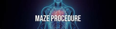 What Is The Maze Procedure Medical Blogs