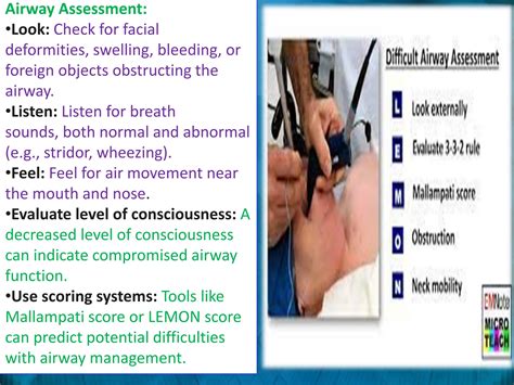 Airway Assessment And Management In Emergency Medicinent Pdf