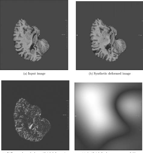 Figure 3 11 From Nonrigid Image Registration Using 3d Convolutional Neural Network With