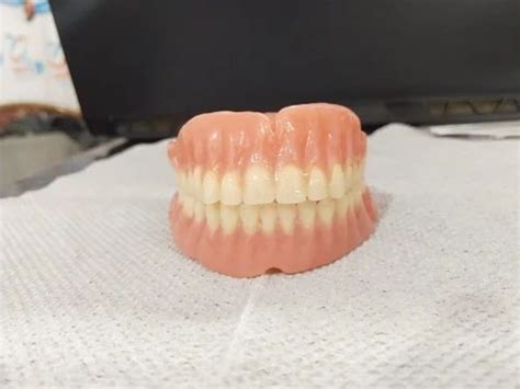 Bps Denture In Hyderabad Id 2852046665812
