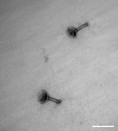 Transmission Electron Micrograph Of T4 Gfp Gfp T4 Phages Diluted In