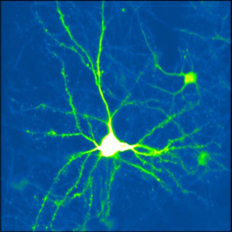 New Brain Pathway Reveals Why The Same Touch Feels Different
