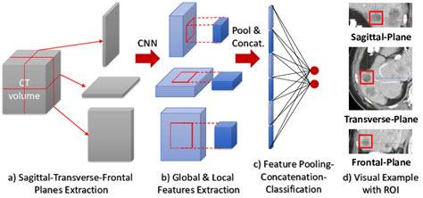 Lesion Proposal Classification Using Global Local Classifier With