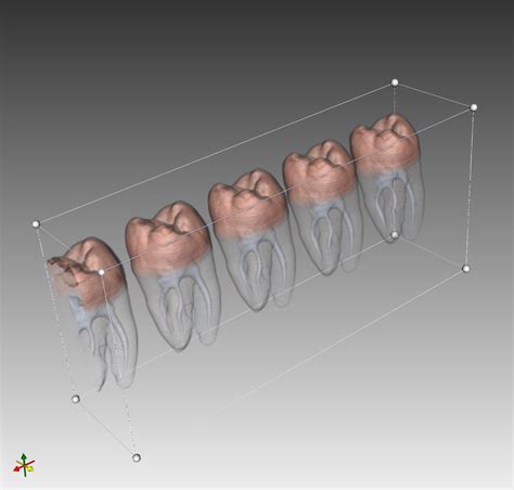 Crop Filter · Issue 772 · Kitwarevtk Js · Github