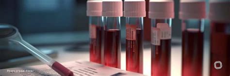 Who Announces First Prequalification Of A Tuberculosis Diagnostic Test Developmentaid