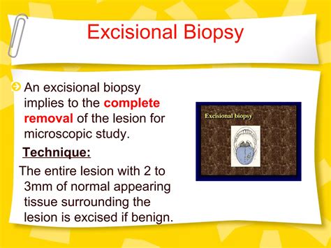 Biopsy Ppt