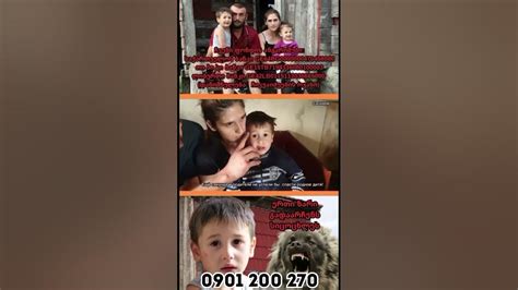 უზარმაზარმა გაცოფებულმა კავკასიურმა ნაგაზმა ბავშვს თავში კბილები ჩაავლო Youtube