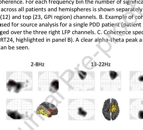 Results Of Between Frequency Anova On Normalised Dics Coherence Images
