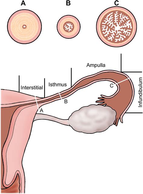 Fallopian Tubes Are Lined By At Mitchell Fredricksen Blog