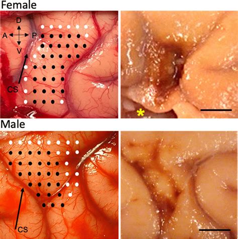 Sex Differences In Recovery Of Motor Function In A Rhesus Monkey Model