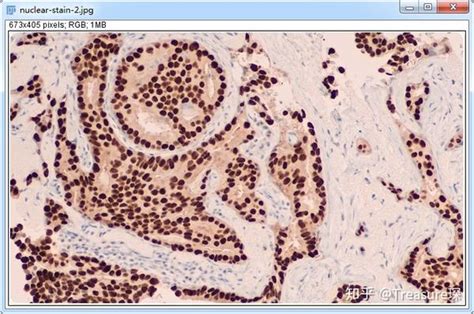 Imagej实用技巧——免疫组化分析 定量分析篇 知乎