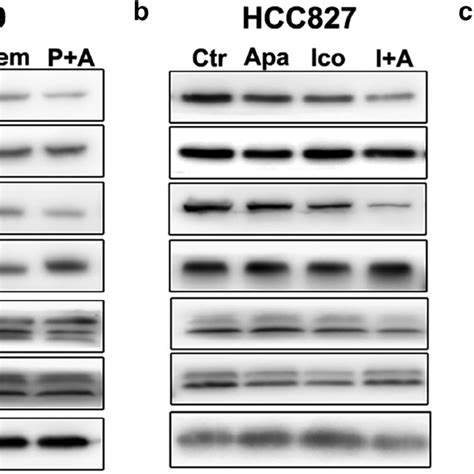 Effects Of Apatinib Combined With Pemetrexed Icotinib Or Osimertinib