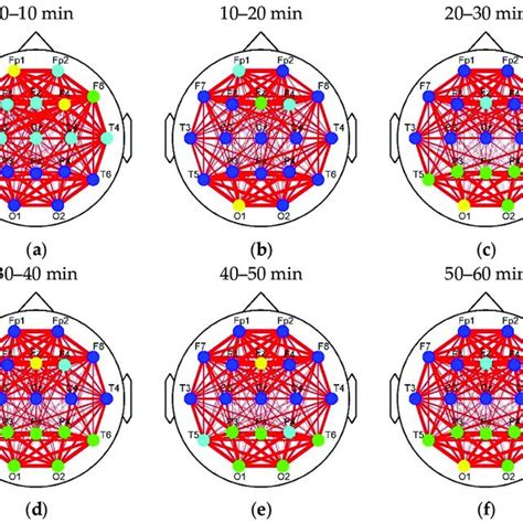 Classification Of Connection Clusters In Each Stage Brain Network Of