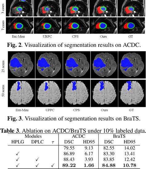 Figure 3 From Semi Supervised Medical Image Segmentation Via Dynamic Pseudo Label Refinement