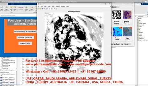 Foot Ulcer Skin Disease Diabetic Foot Ulcer Segmentation Classification