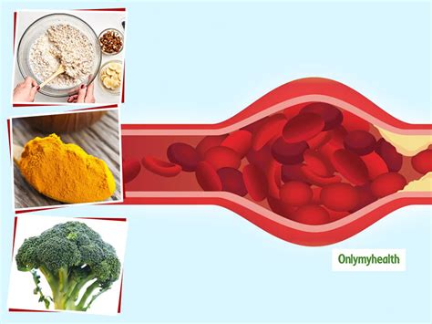 Cholesterol Clogged Arteries Symptoms 5 Foods To Decrease Ldl Triglycerides Level Onlymyhealth