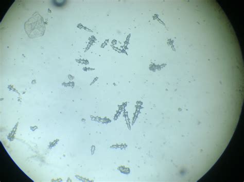 What Is This Sponge Species ResearchGate