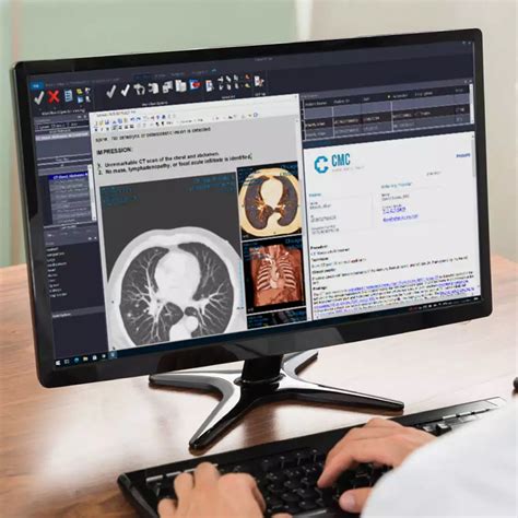 Radiology Informatics Philips