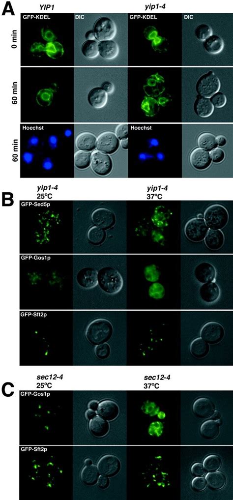 Distribution Of Gfp Tagged Proteins In Wild Type And Yip1 4 Strains